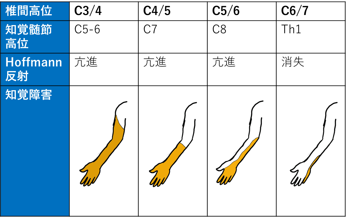 finger escape sign とは: 脊髄 高位診断 – DentalCoalition