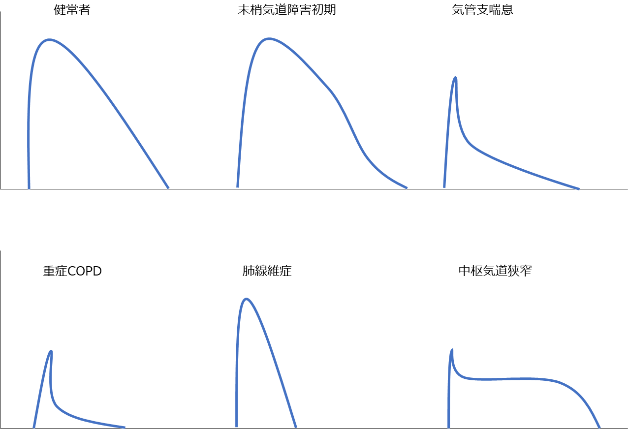 呼吸機能検査│不識庵-万年研修医のブログ-