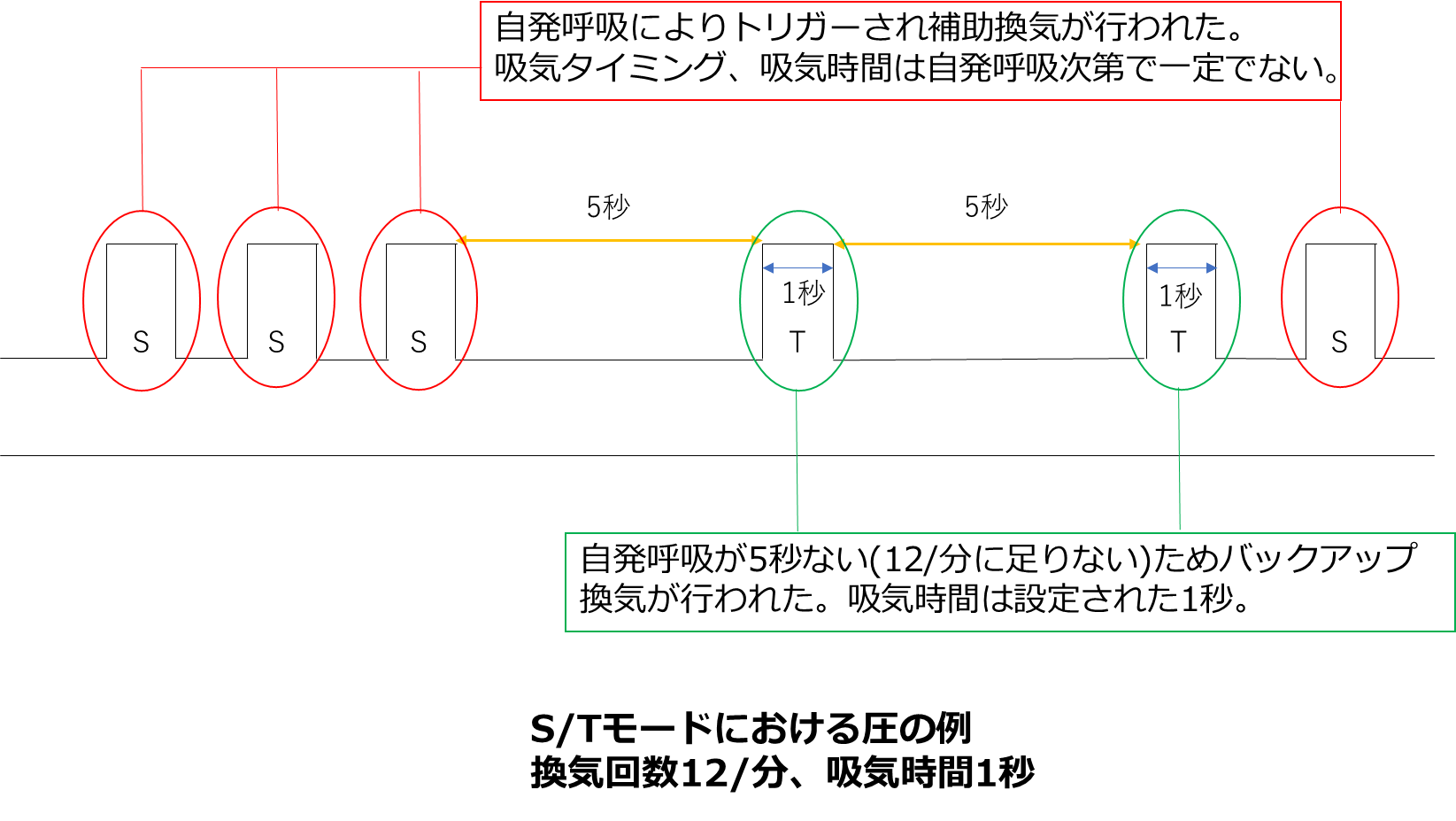 非侵襲的陽圧換気療法(NPPV)│不識庵-万年研修医のブログ-